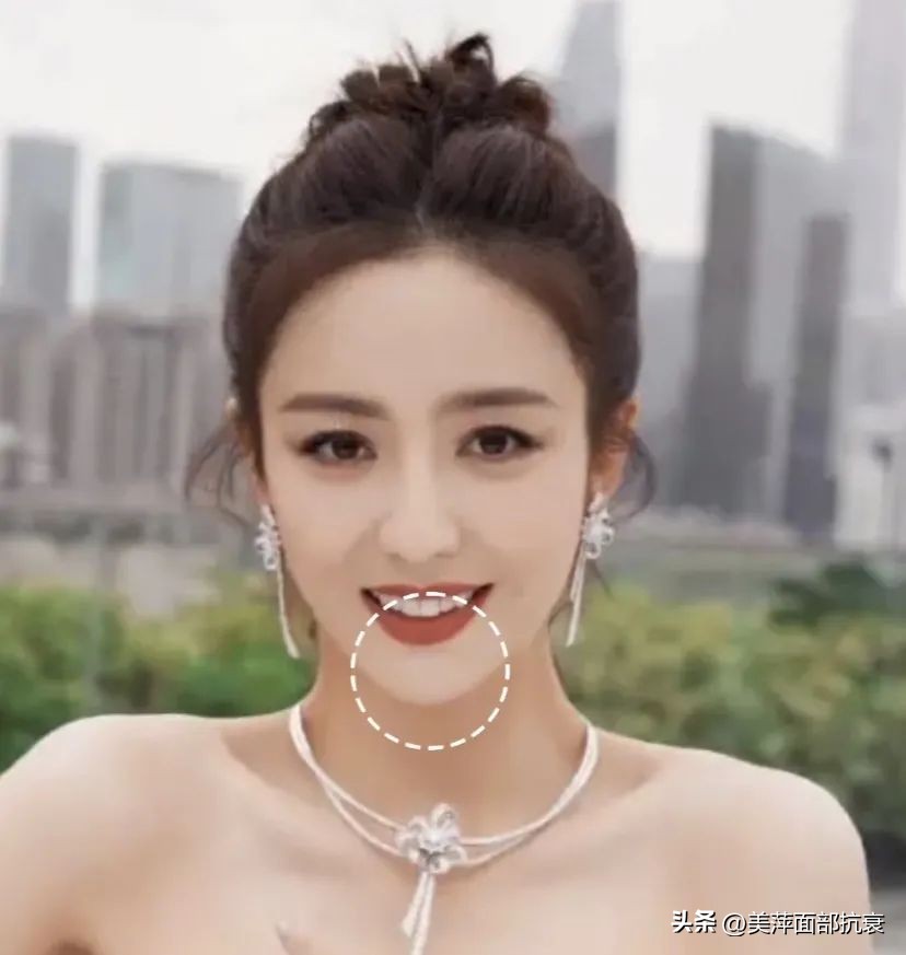 Even Tong Liya has not escaped the double chin problem, in fact, 2-step ...