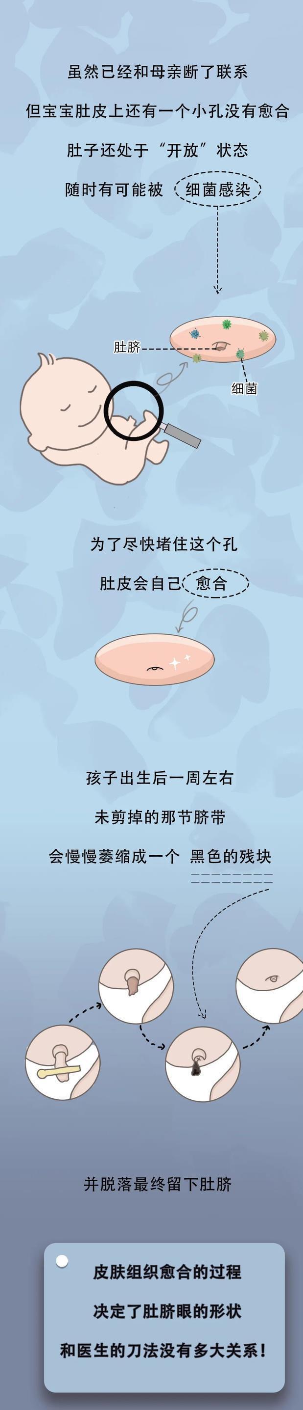 Where does the belly button lead?Does picking your belly button hurt ...