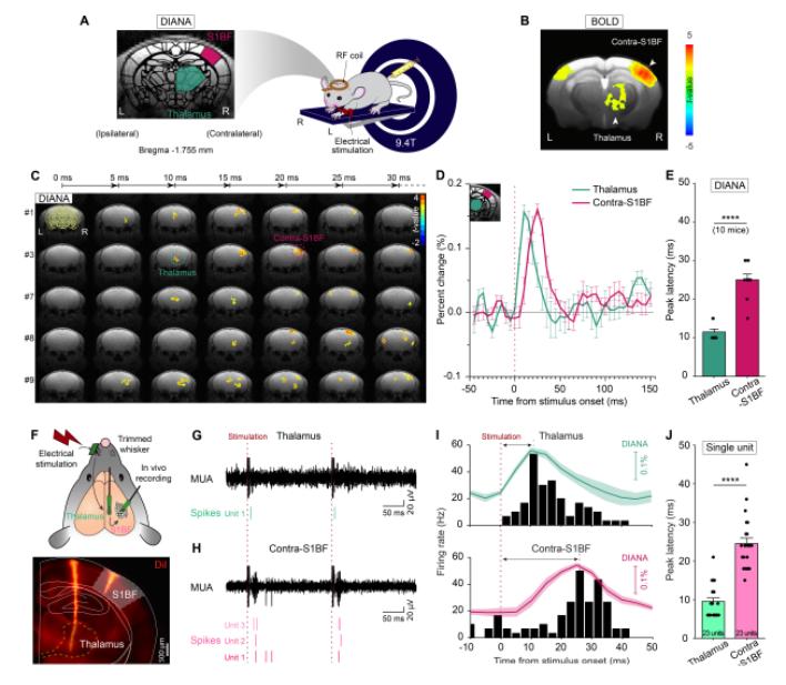 Neuroimaging ushered in reform, South Korean scientists achieved direct ...