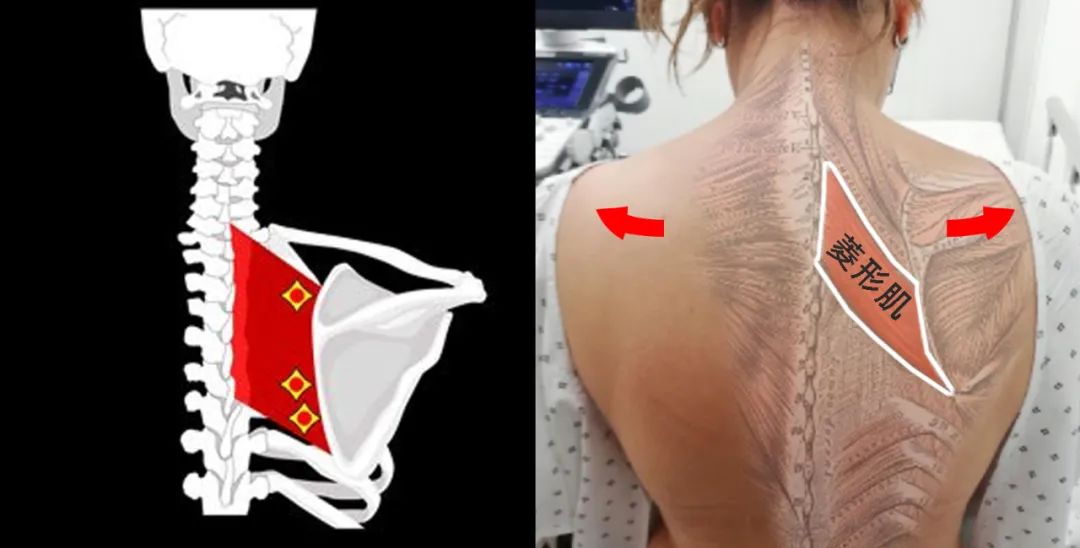 The seam between the shoulder blades always hurts!What to do?How common ...