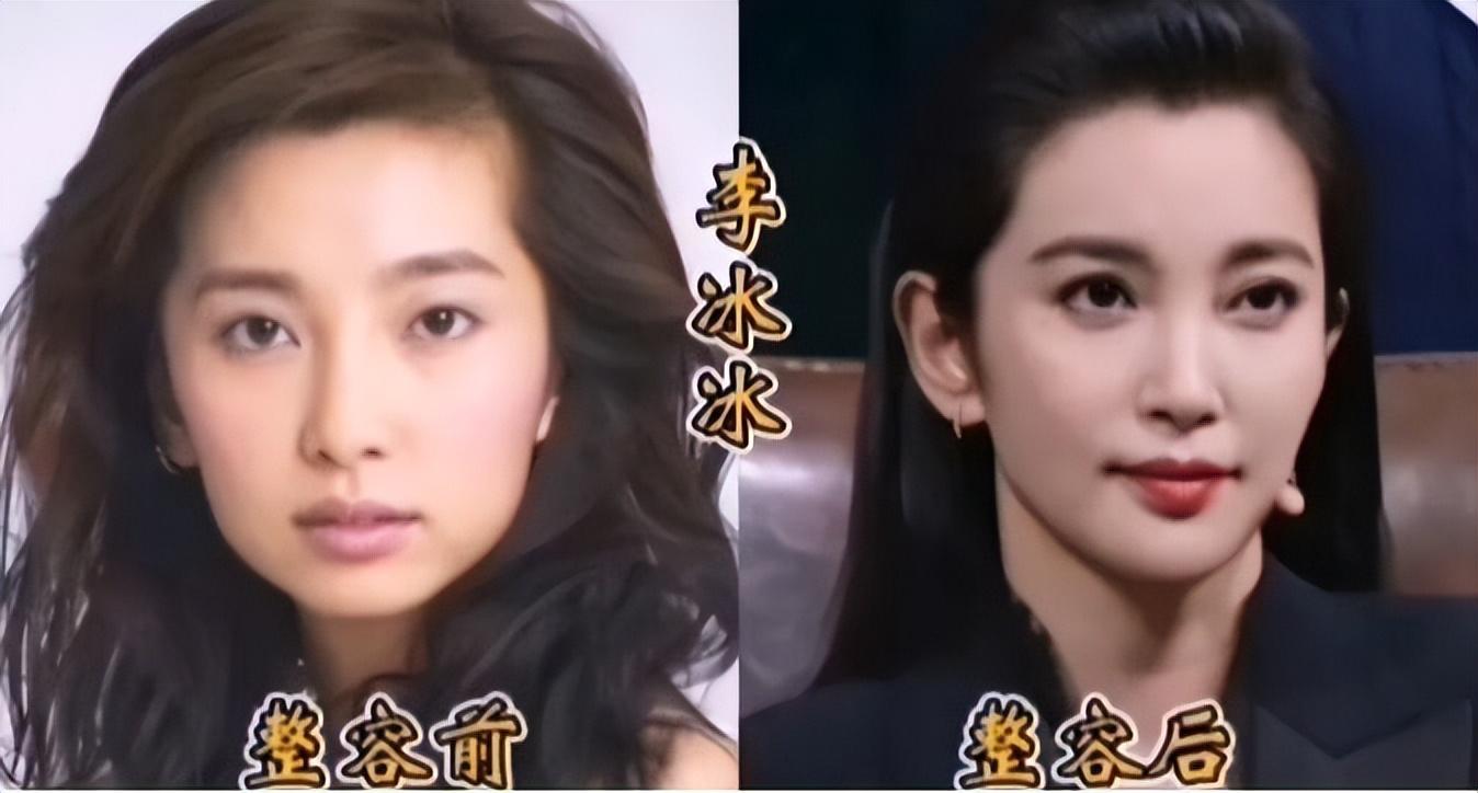Comparing actresses before and after plastic surgery, Li Bingbing and Joey Yung's appearance ...