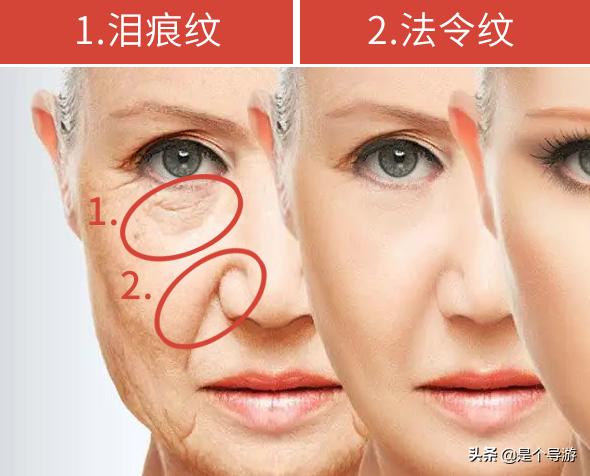 How to get rid of deep splayed lines on both sides of nose?How to ...