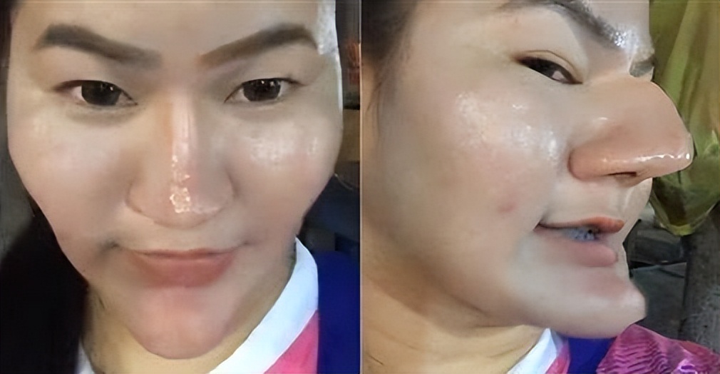 Girls spend millions on plastic surgery, want to become "princesses ...