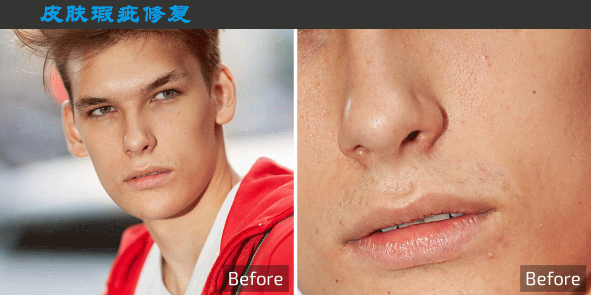 The best microdermabrasion plug-in comes the latest Retouch4me 10 sets ...