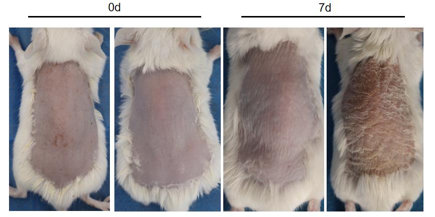 Construction of mouse psoriasis model and related mechanism research ...