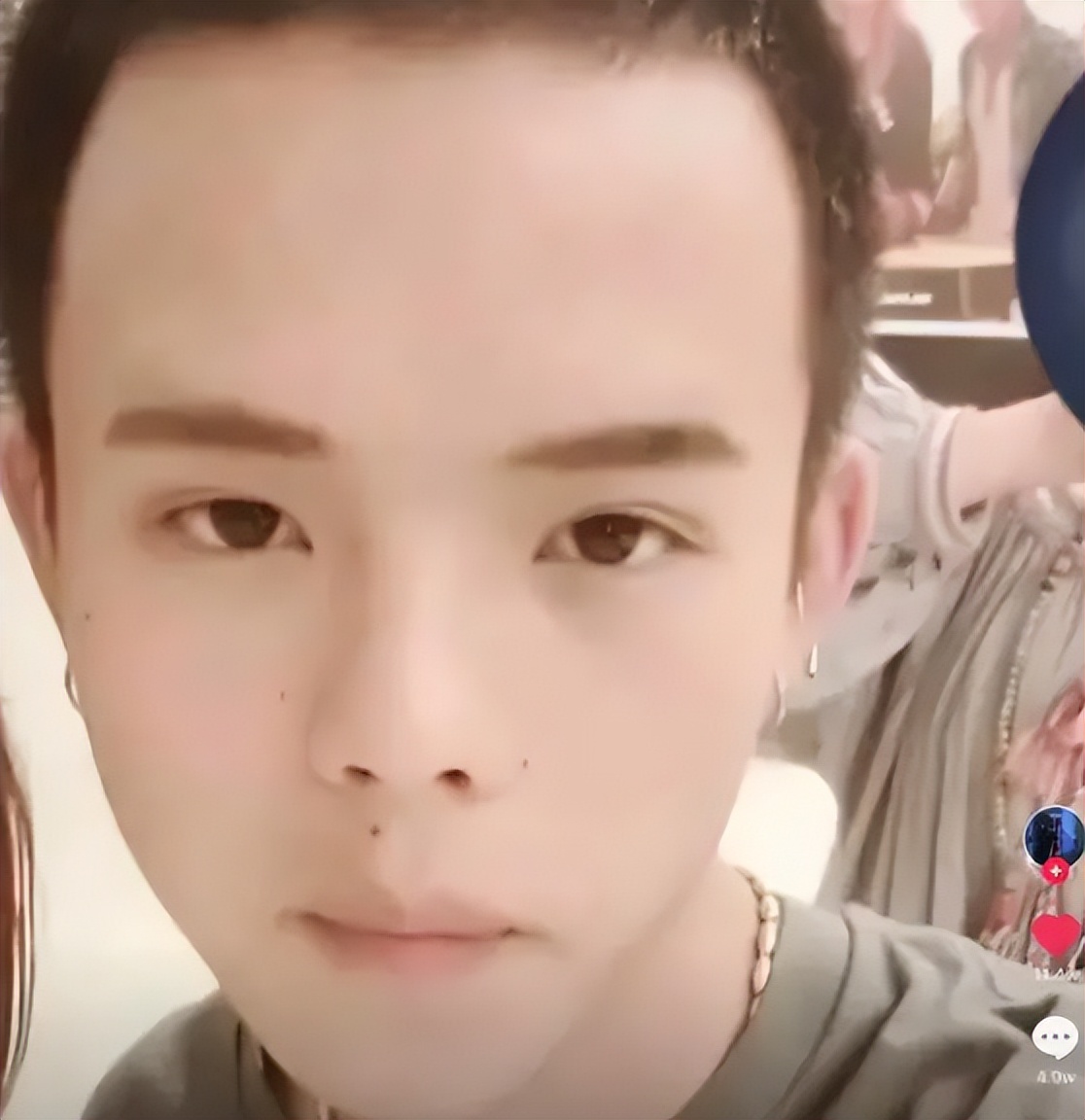 Yin Shihang disclosed his experience of plastic surgery, many stitches ...