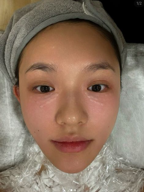 So true! Lin Yunshao's process of applying hydro-acupuncture, the ...