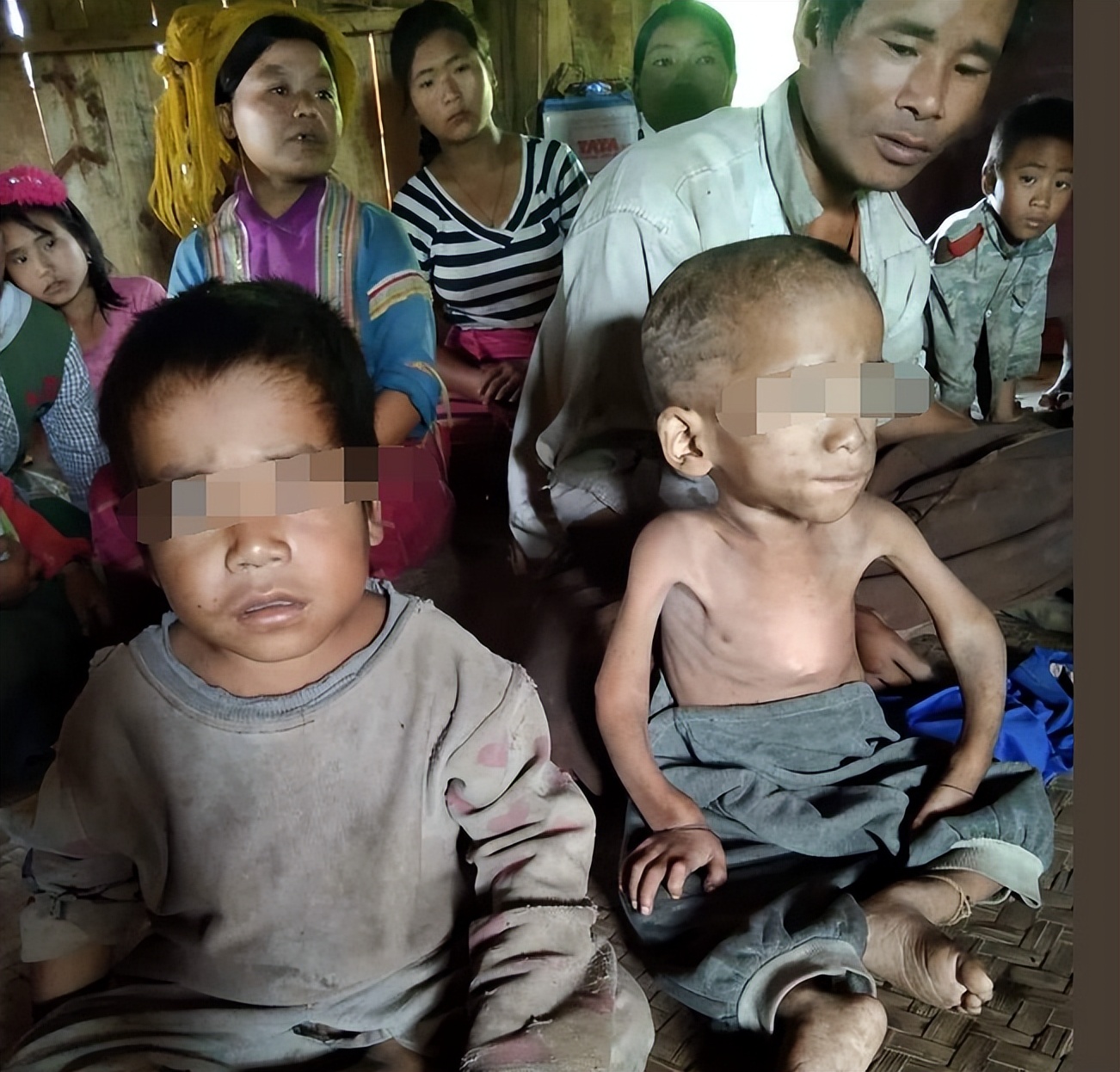 2 children in Dangyang, northern Myanmar suffer from strange illness ...