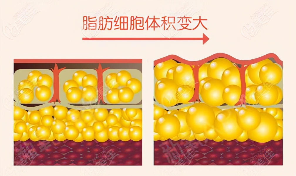 What are the two dimples on the back of a woman's waist?not everyone ...