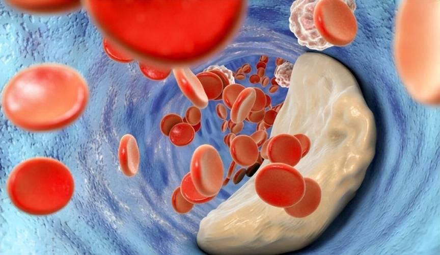 Traditional Chinese Medicine: blood stasis will cause spots, improve ...