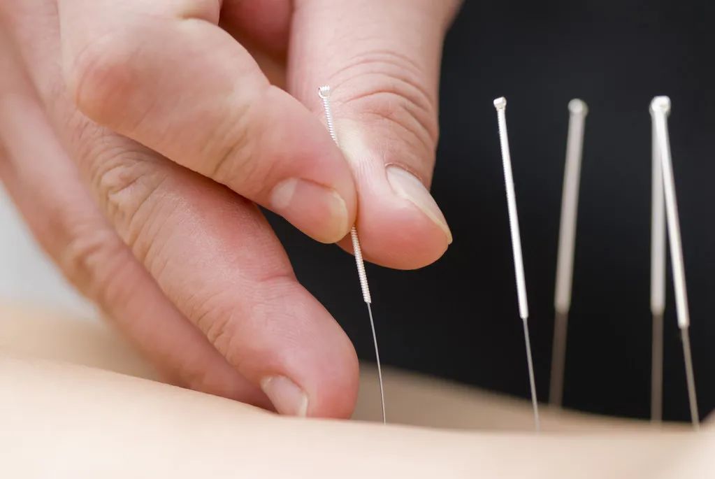 Common Acupuncture Points "Ashi Point" - iNEWS