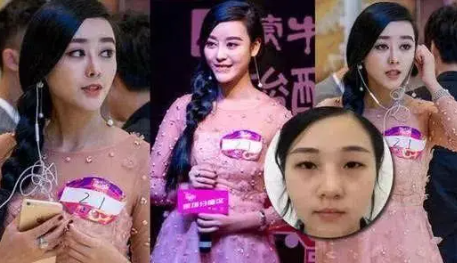 He Chengxi: What happened after spending 8 million plastic surgery to ...