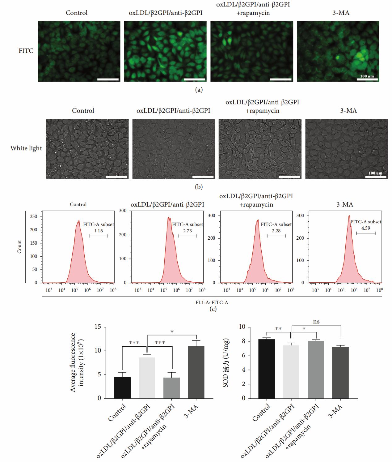 Impaired autophagy induced by oxLDL/anti-β2GPI complex through PI3K and ...