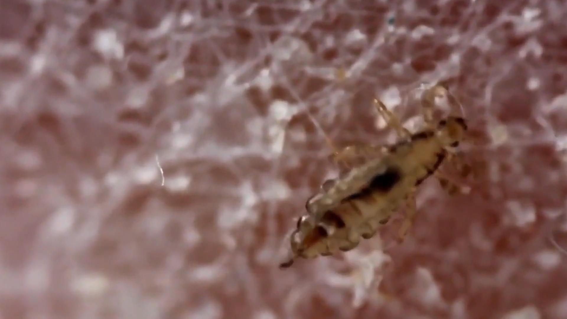 Lice that used to be common but are now hard to see? What are the ...