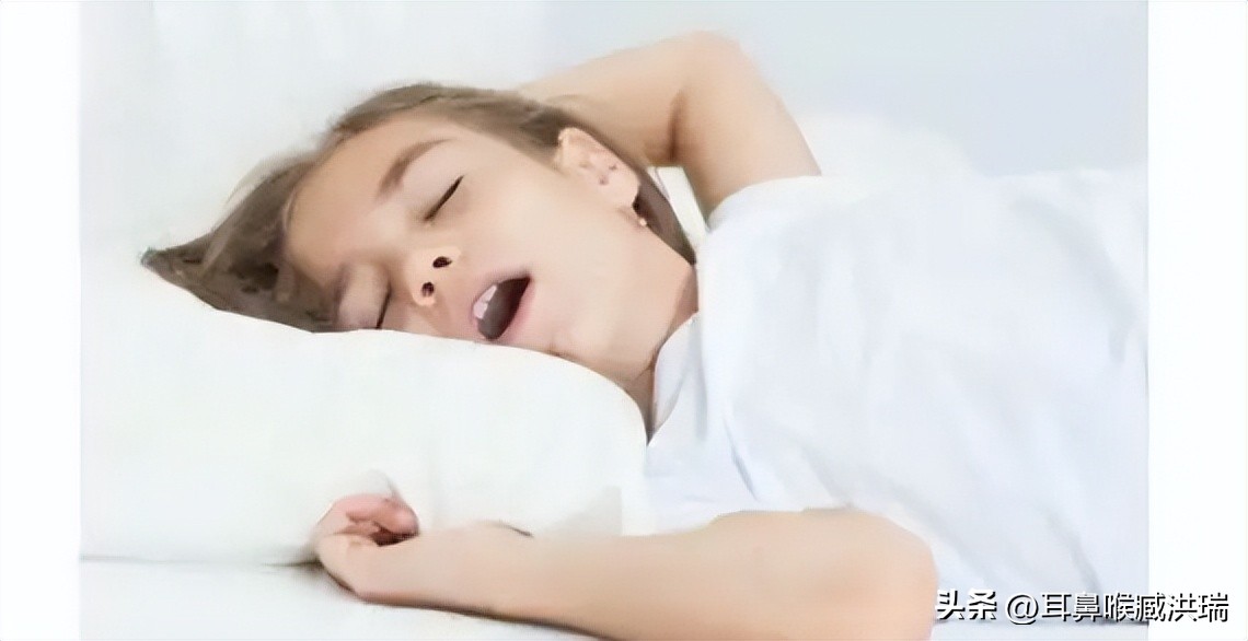 Adenoid Knowledge Collection: How can parents properly prevent and ...