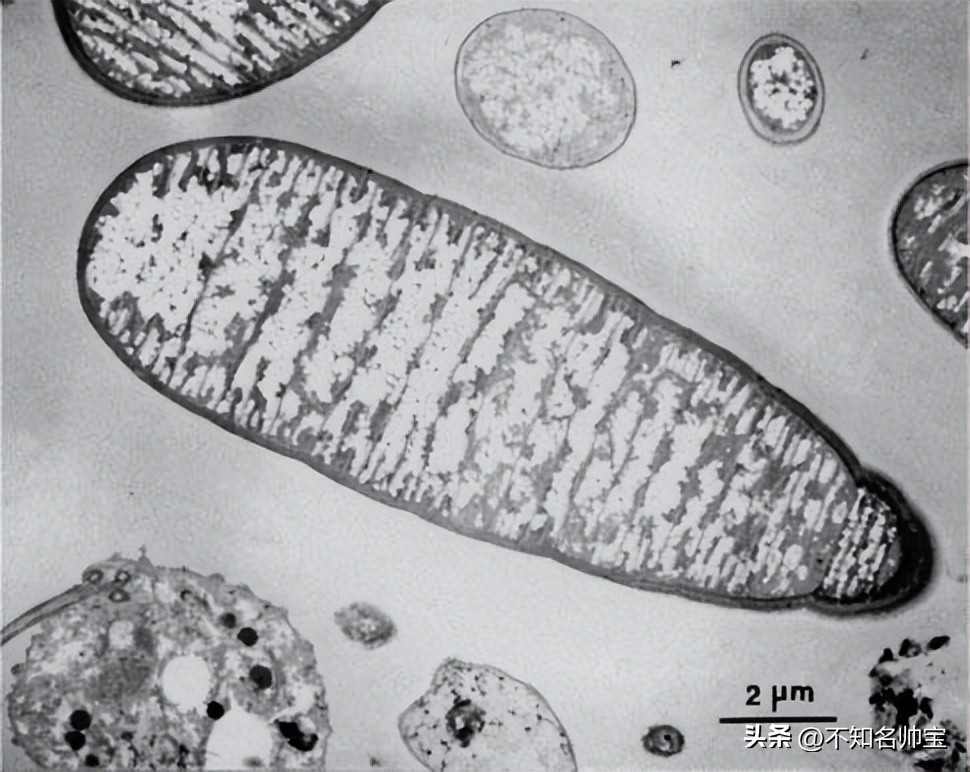 Ancient companion-self-secretion of pili into hyperelastic zigzag ...