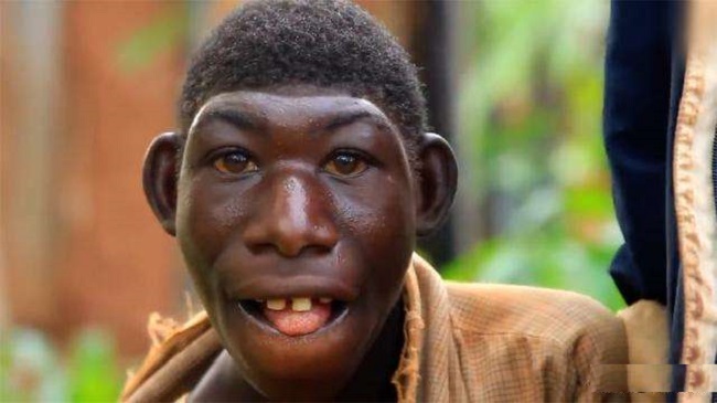 African "monkey boy" can't speak but scream, fans earn millions every ...