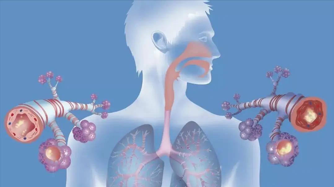 What are the dangers of kitchen fumes?How to avoid it?It is recommended ...