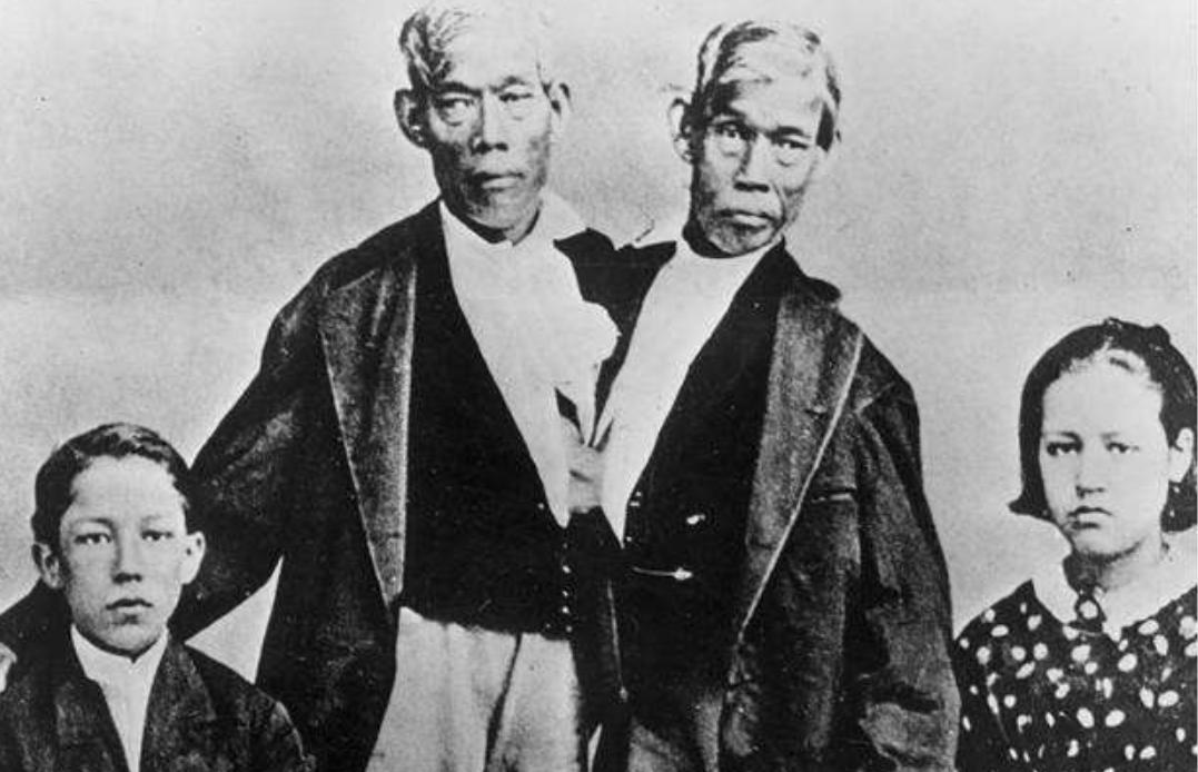 Siamese brothers in Thailand married their sisters and gave birth to 22 ...