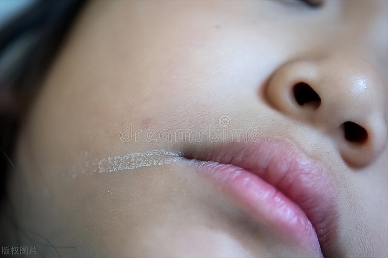 Don't underestimate "sleep drooling", if it happens often, or it ...