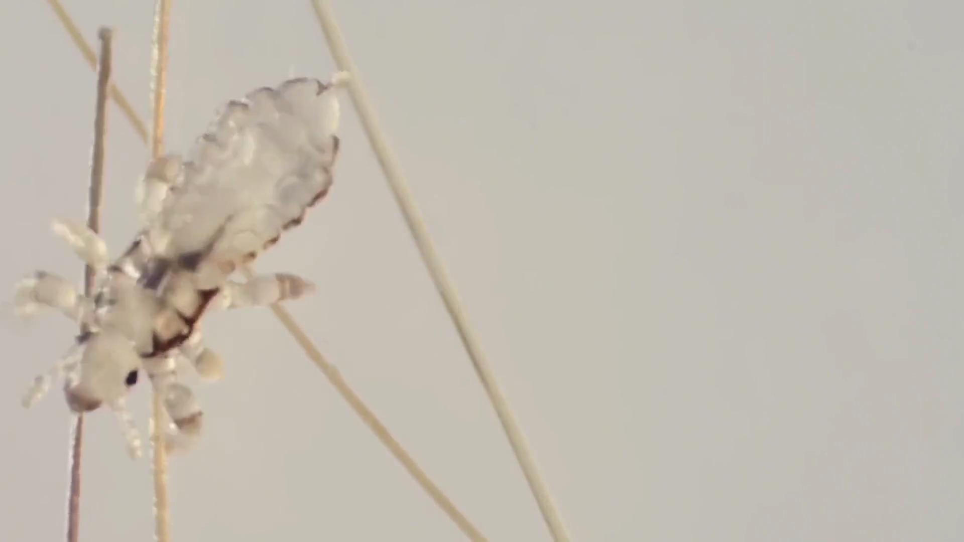 Lice that used to be common but are now hard to see? What are the ...