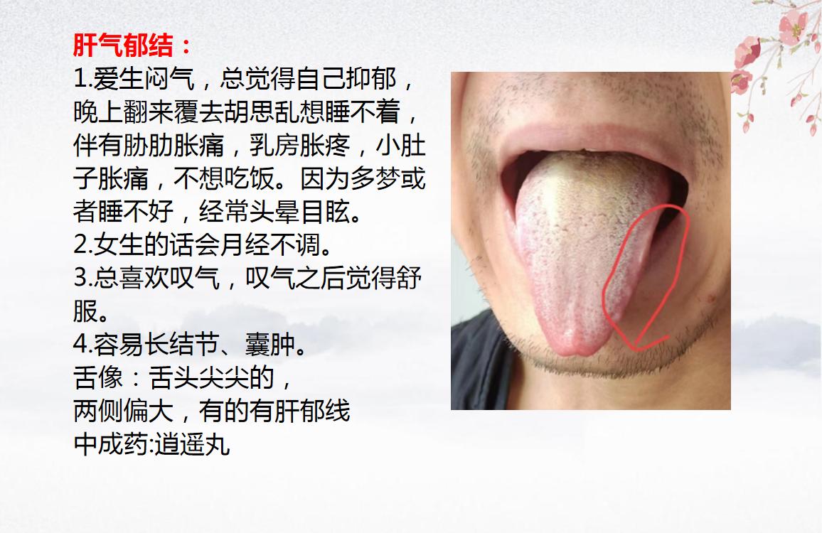 What are the symptoms of yin deficiency, yang deficiency, qi and blood ...