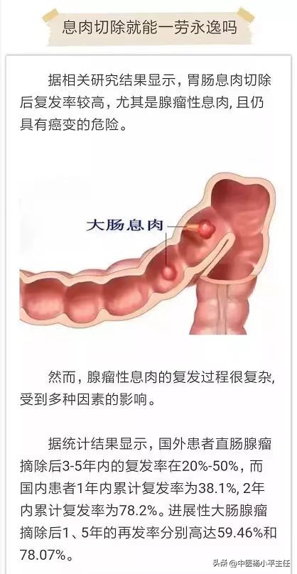 Gastrointestinal polyps, will everything be all right after removal ...