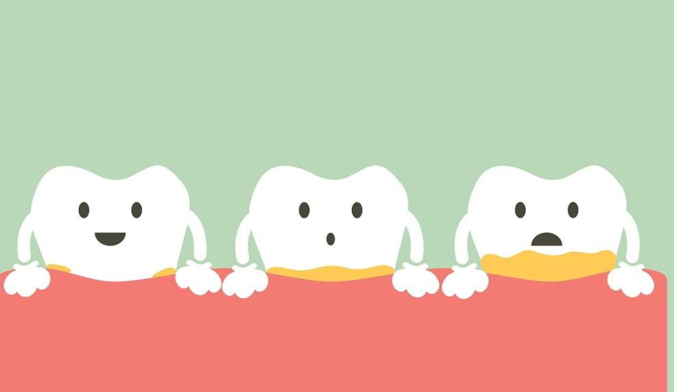 How to remove calculus between teeth? Doctor: Teach you 3 ways to ...