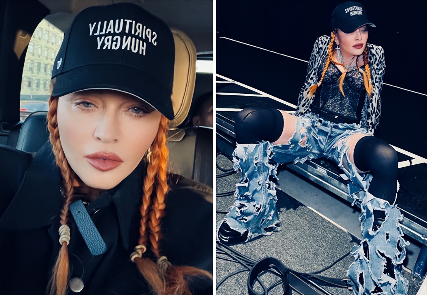 64-year-old Madonna admits plastic surgery! The swelling of the steamed ...