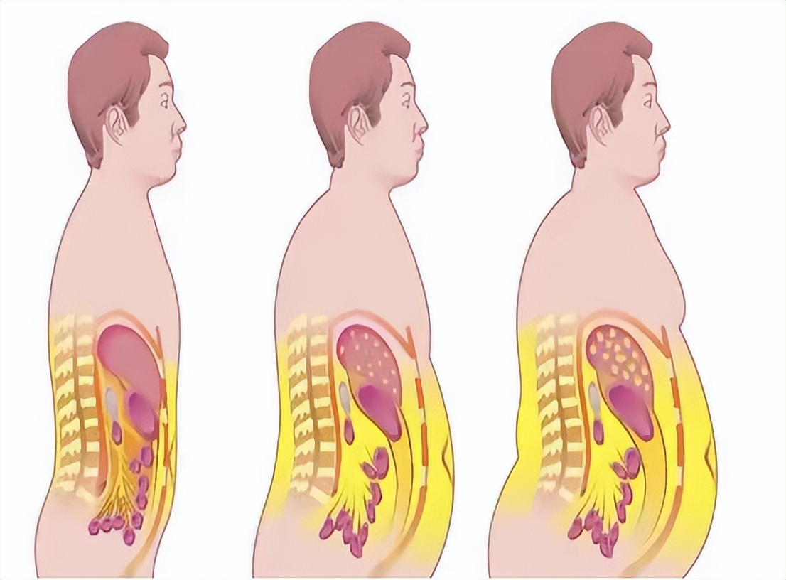 Eat as little as possible the foods that make your belly grow fat - iNEWS