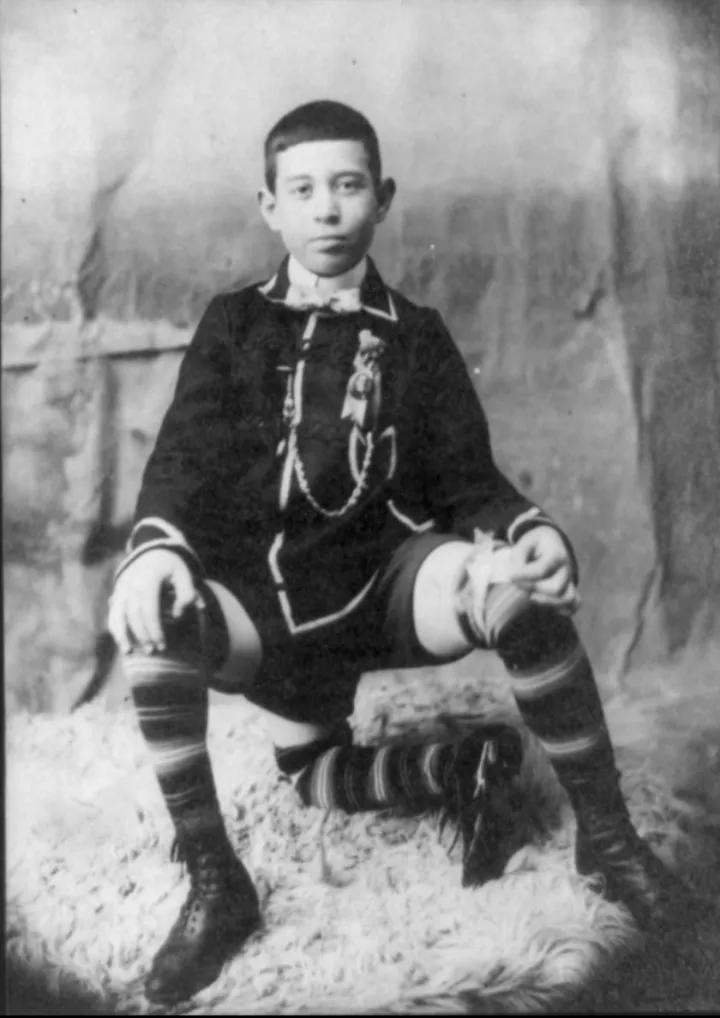 A 3-legged man became a cash cow of the circus. After becoming famous ...