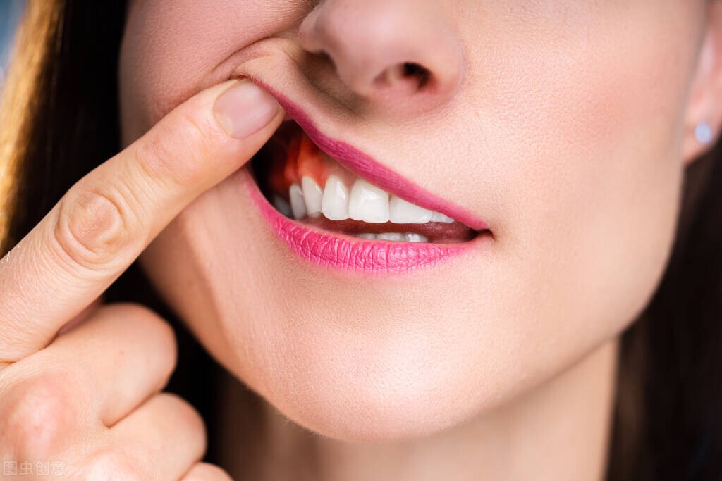 Toothache disease, should antibiotics be used? - iNEWS