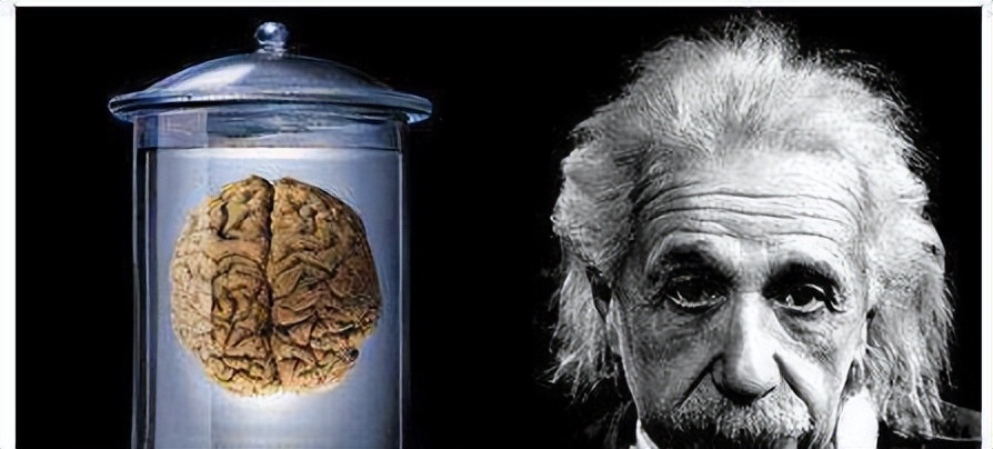 Ten surprising facts about the human brain - iNEWS