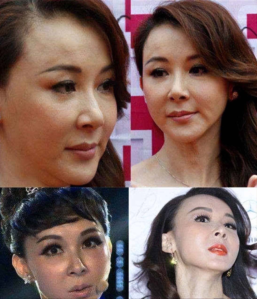 Morbid plastic surgery, face changing addiction, deformed aesthetics ...