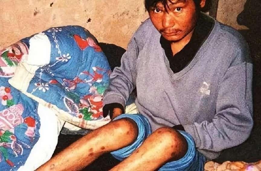 Wang Shuping: The forgotten "whistleblower", who saved tens of ...