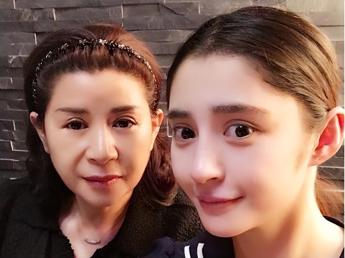 There is a kind of plastic surgery called "Splendid Weiyang" Li Changle ...