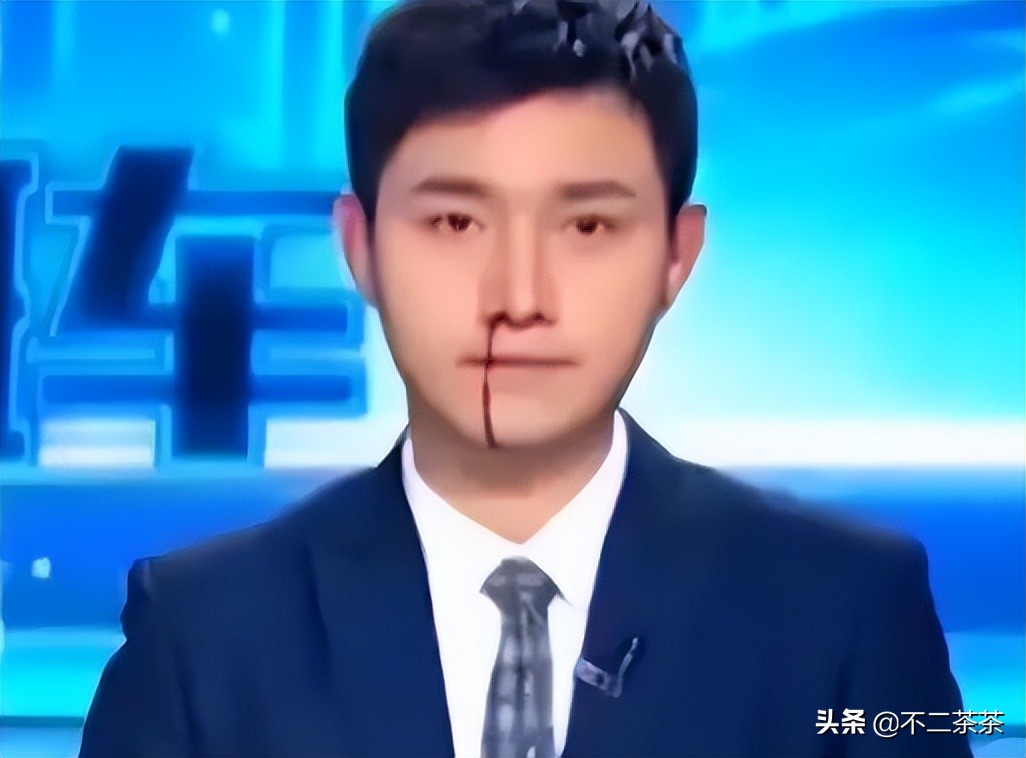 After watching the live broadcast of the news host with nosebleeds, I ...