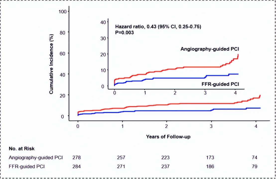 Application value of FFR-guided PCI for complete revascularization in patients with AMI ...