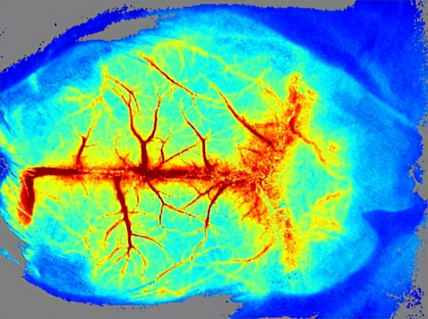 RFLSI ZW Laser Speckle Flow Imaging System, Unparalleled Imaging ...