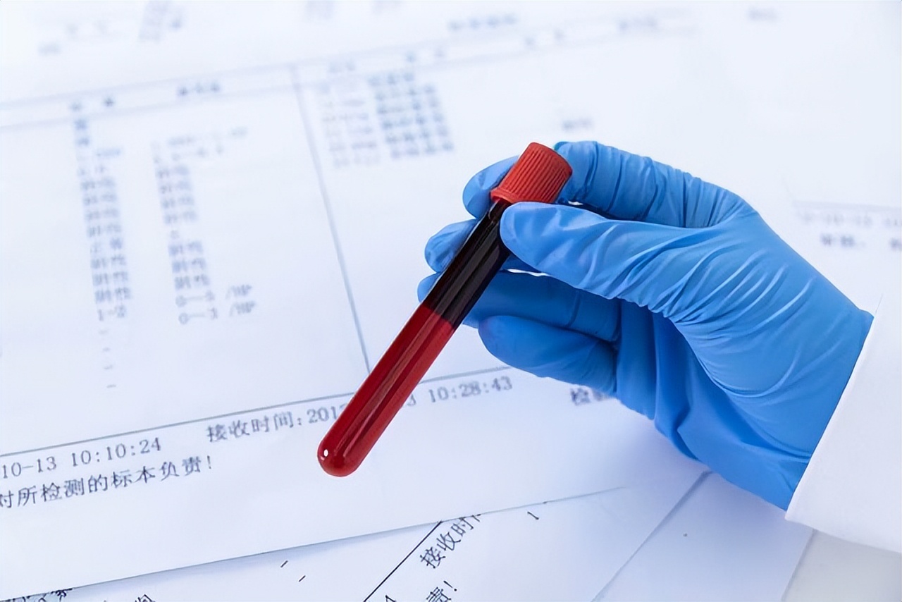 In the blood routine examination, if there are 5 indicators that rise ...