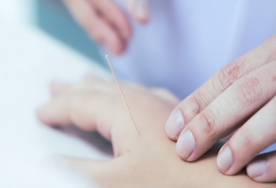 Can paralysis caused by stroke still be saved? Can acupuncture be used ...