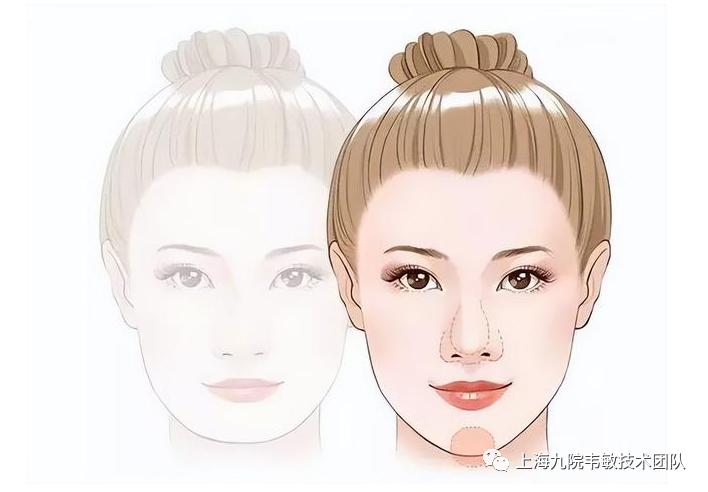 How to distinguish between a short chin and a receding chin? - iMedia