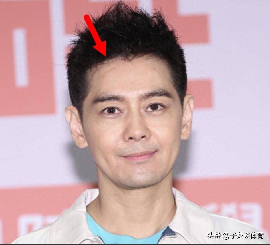Jimmy Lin revealed his facial scars publicly for the first time after ...