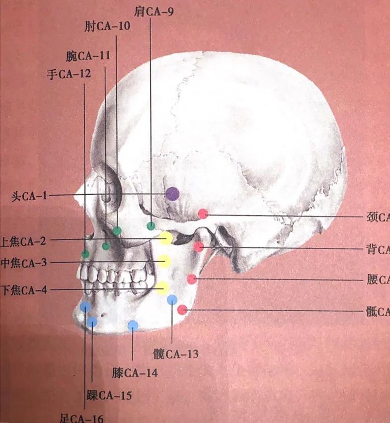 Acute and chronic pain conditioning - buccal acupuncture - iNEWS