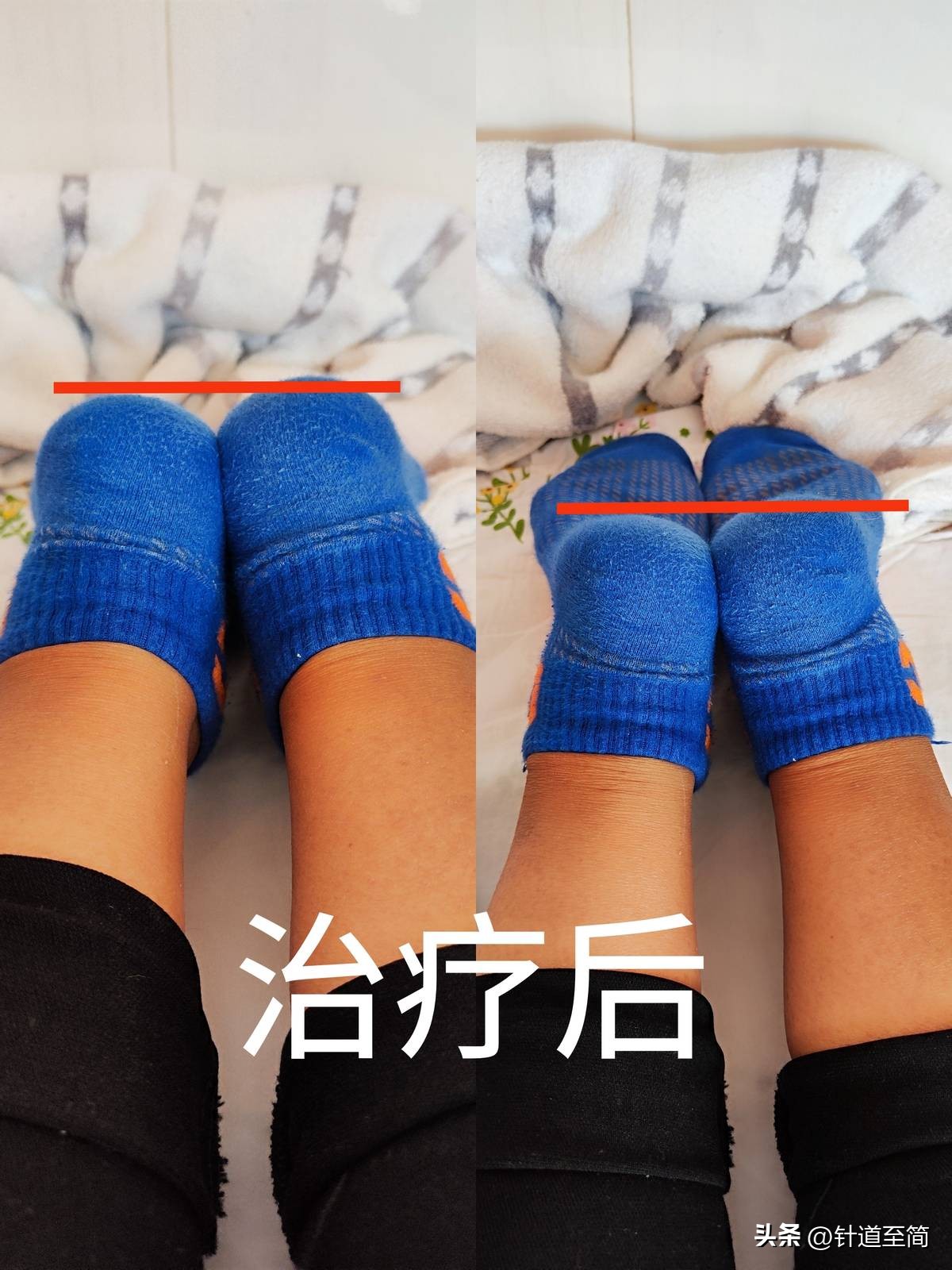 Long and short legs?Chinese medicine has a method - iNEWS