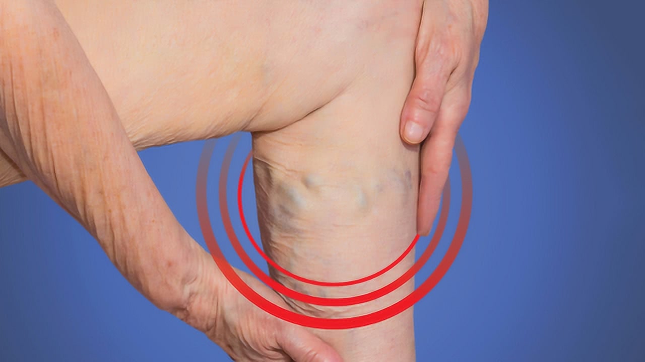 Sudden leg cramps while sleeping, is it calcium deficiency? wrong ...