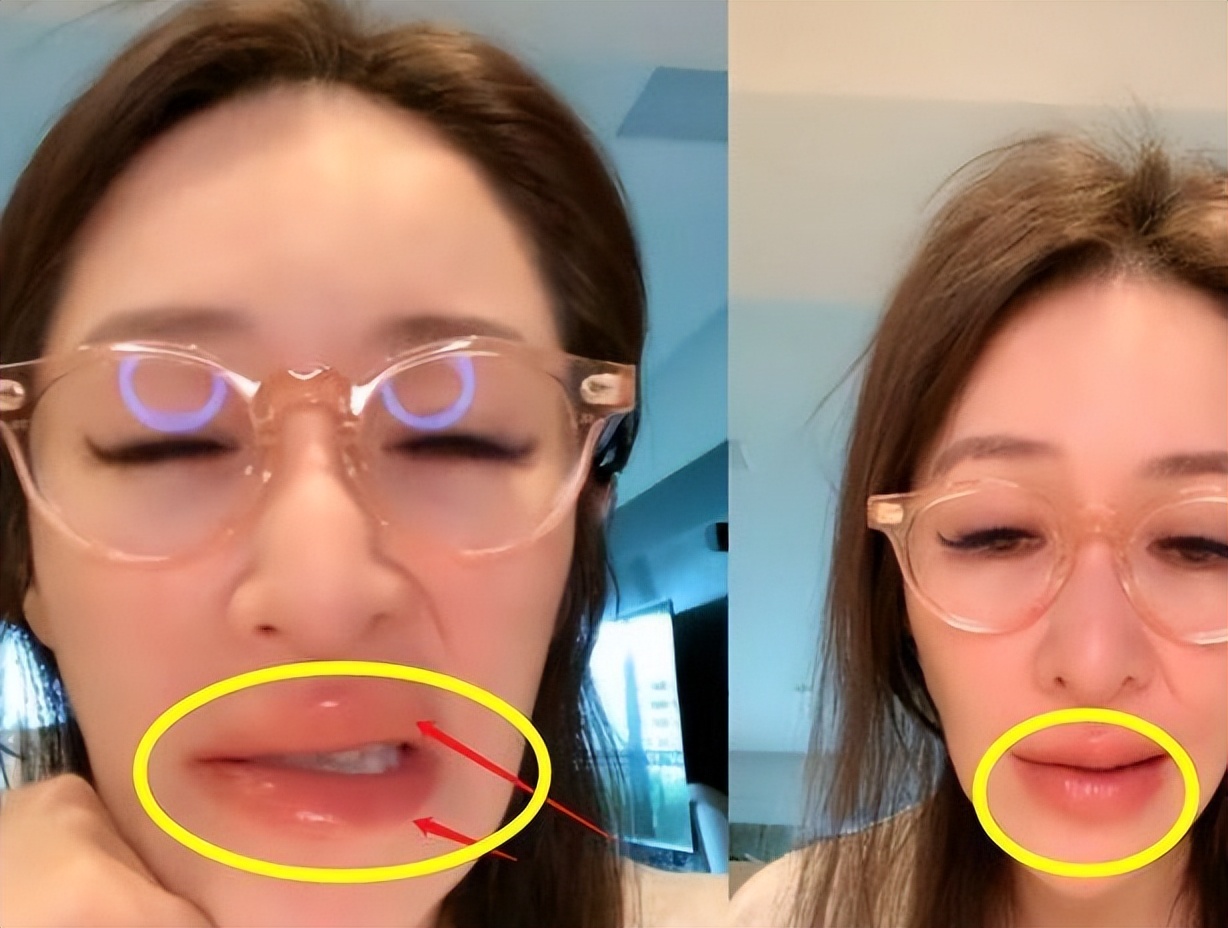 Xiao Yaxuan broke up with her little boyfriend, suspected of "lack of energy", and her facial ...