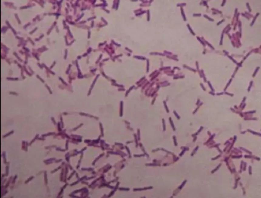 Russian professor and German actor inject 3.5 million-year-old bacteria ...