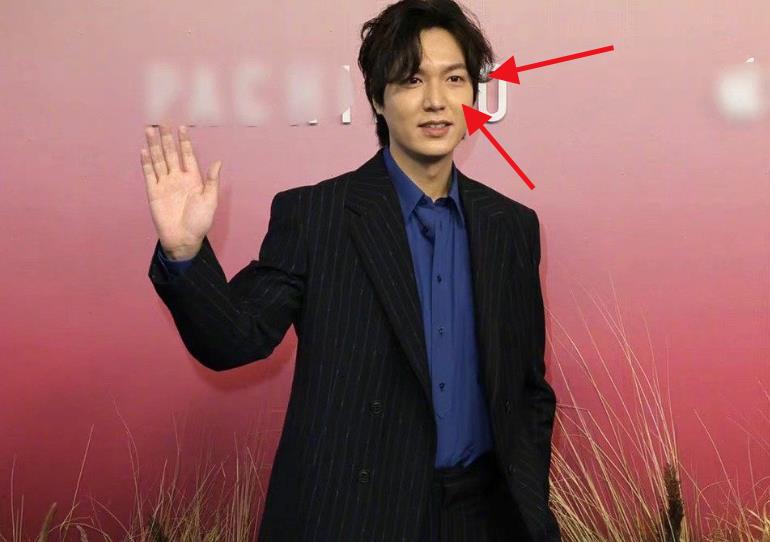 A recent photo of Lee Min Ho with sunken cheeks, he lost weight for the ...