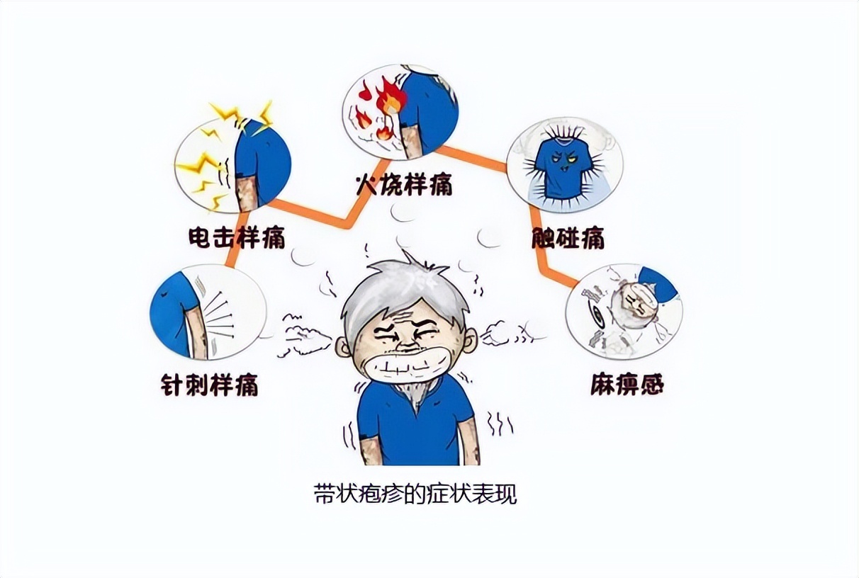 Shingles, try these two traditional Chinese medicines, or it can be ...